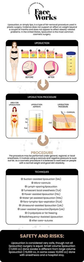 Hi-Def Liposuction Specialist Near Me in Schaumburg, IL